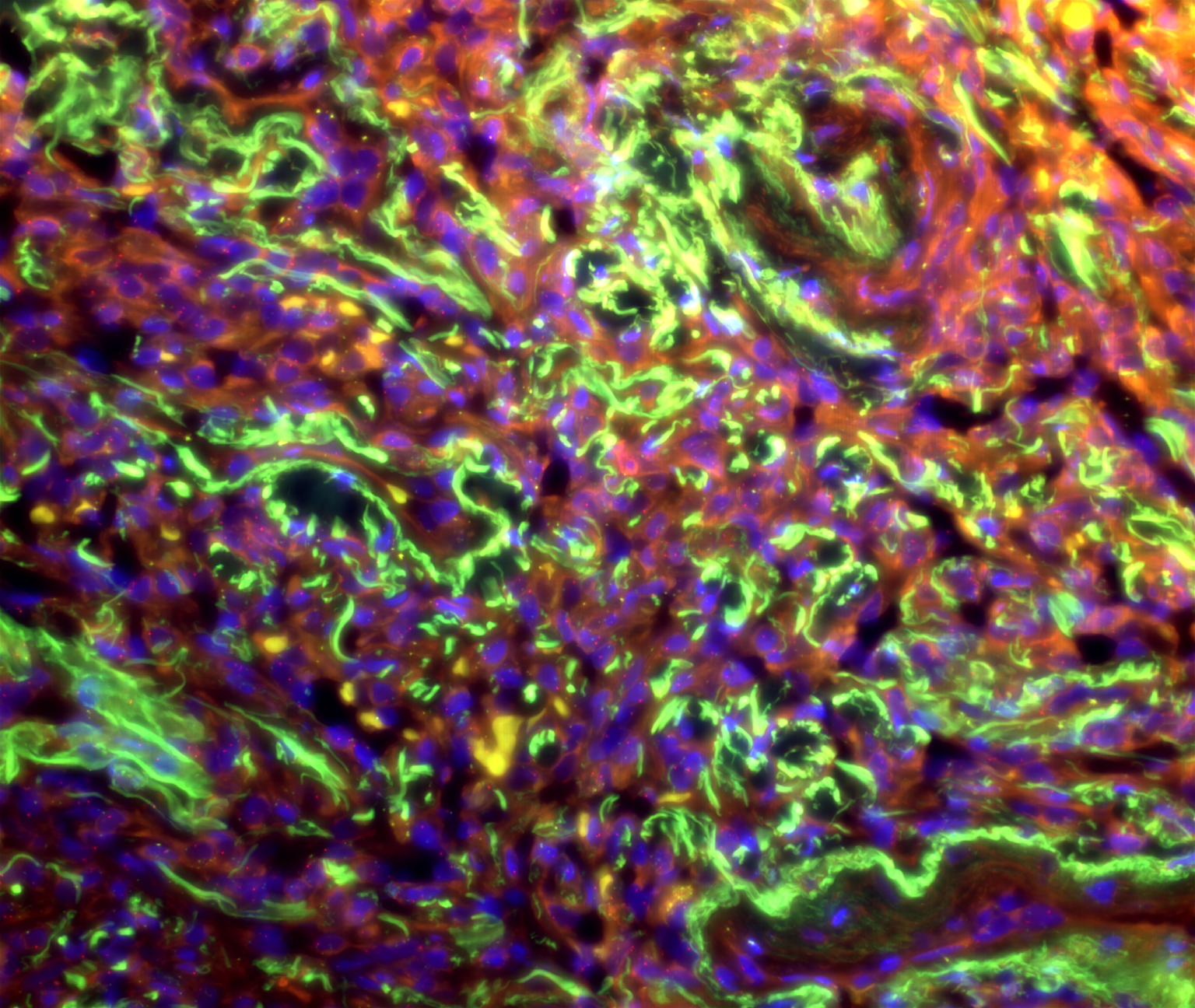 Images by Triple DAPI/FITC/TexasRed PN33012 – Optical Filter ...