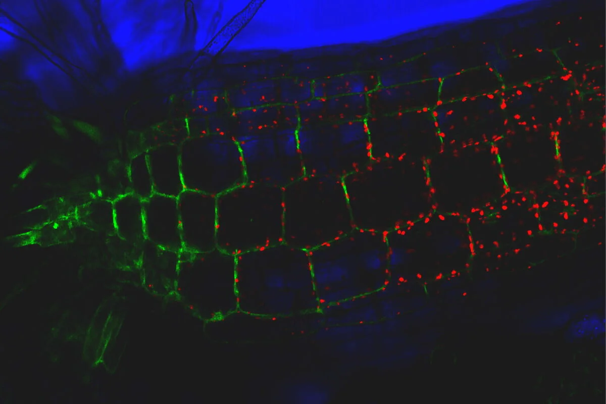 How to Quantify Fluorescence Microscopy for Accurate Analysis – Optical ...